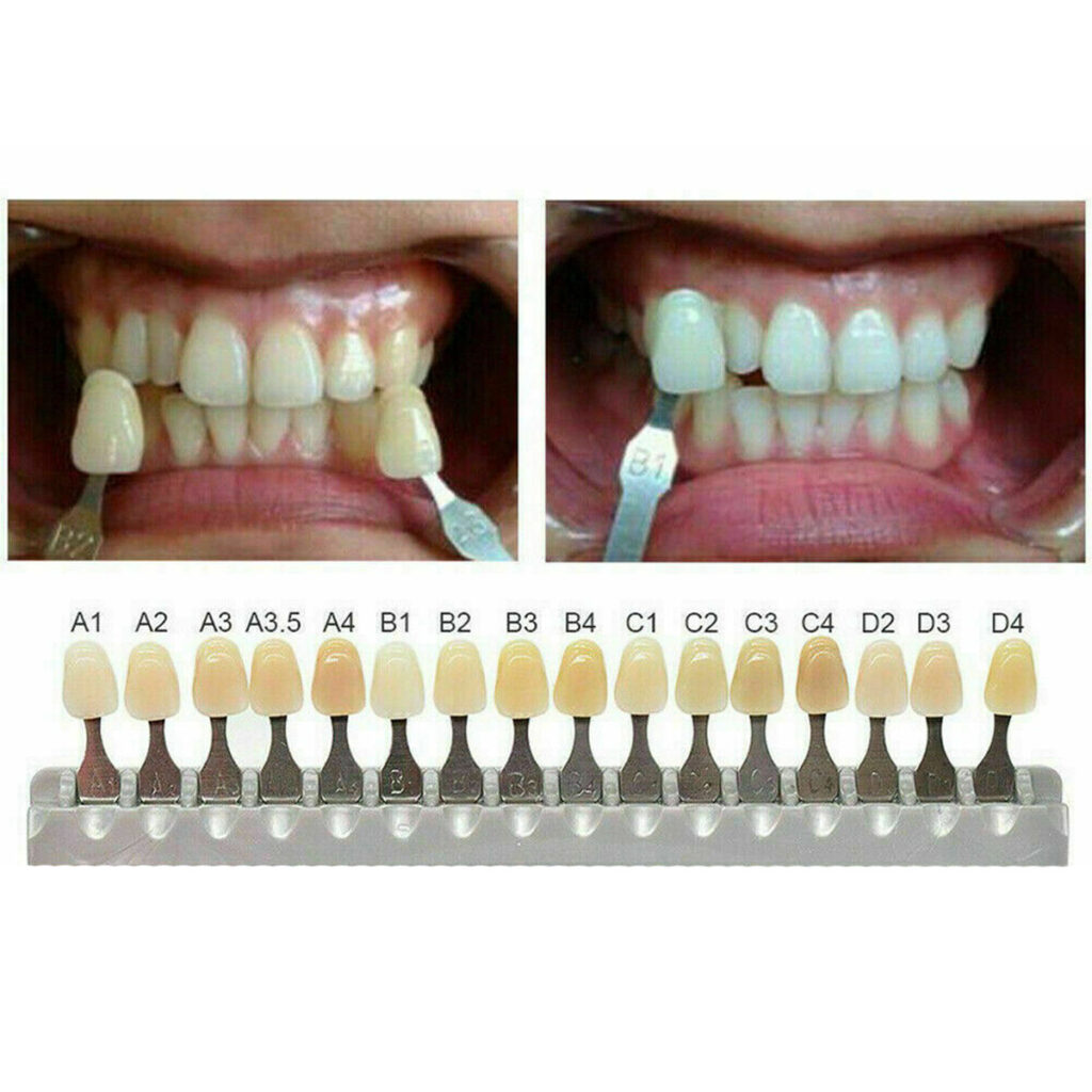 Vita Classical Shade Guide - Sadguru Dentals